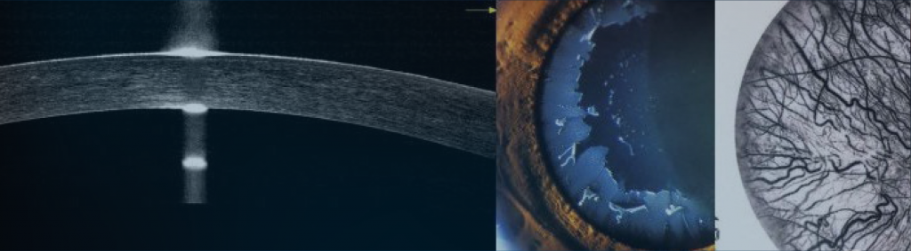 New England Ophthalmological Society